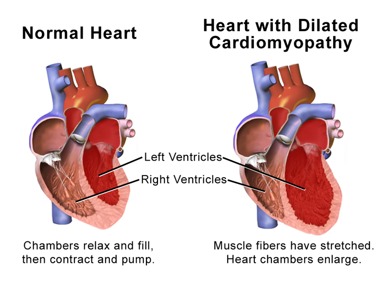 How Long Can A Dog Live With Stage 4 Heart Failure